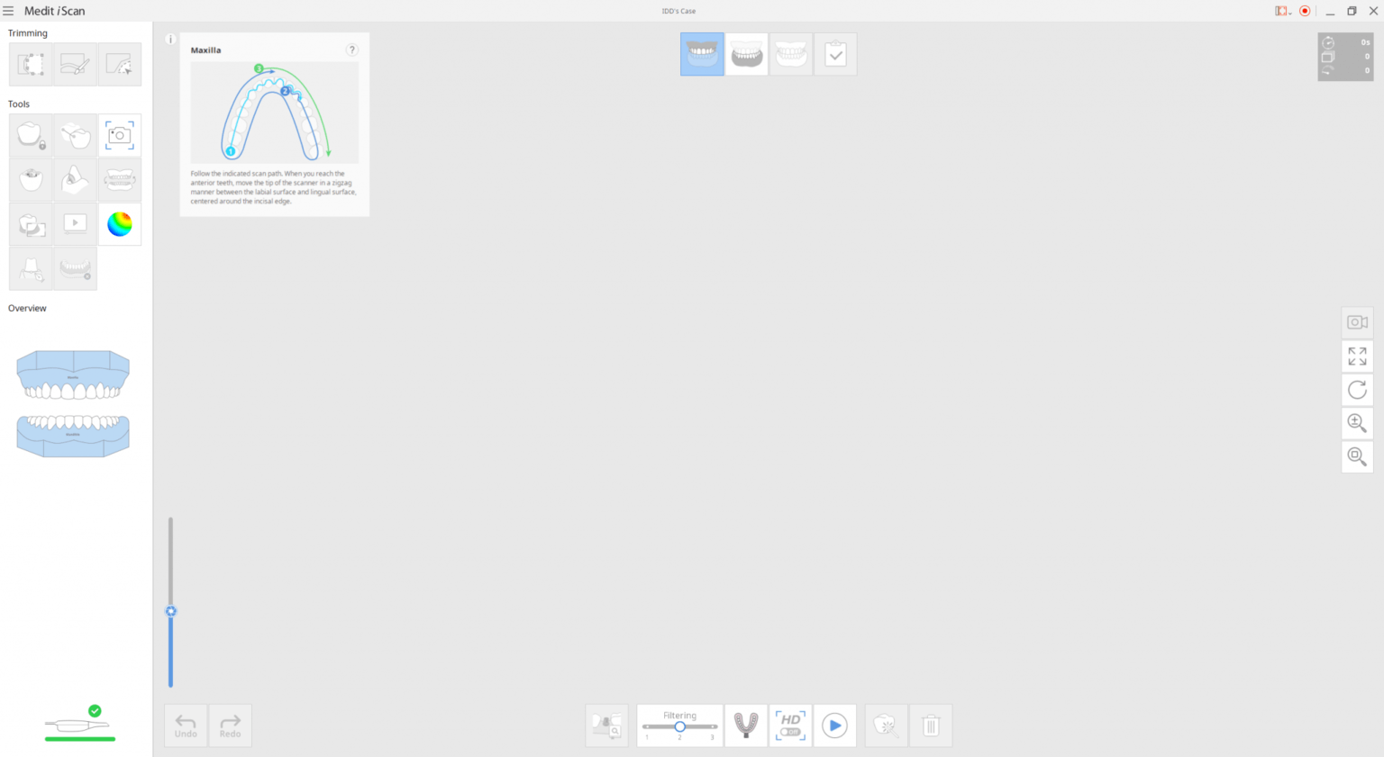 Medit i500 Review | Digital Dentistry Blog | Online Training & Courses