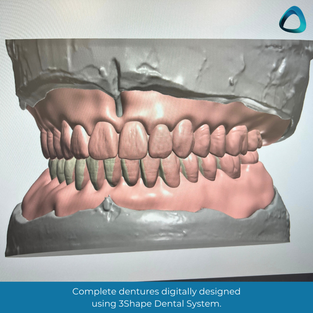 Digital Workflows for Digital Dentures