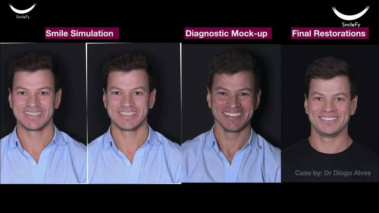 How AI is Transforming Cosmetic Dentistry with SmileFy - Institute of ...